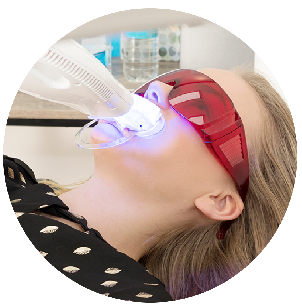 ZOOM! Whitening Makes Teeth Whiter In About An Hour - Fast & Durable