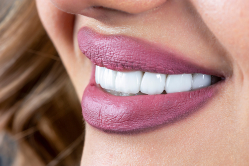 Types of Porcelain Veneers - Cosmetic Dentistry - Zoma Dental